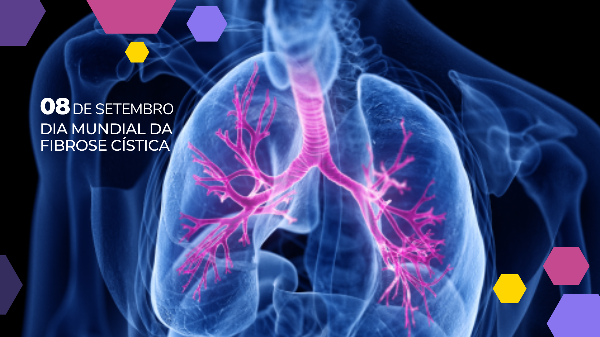 08/9: Dia Mundial da Fibrose Cística - Medicina de Precisão através da ...